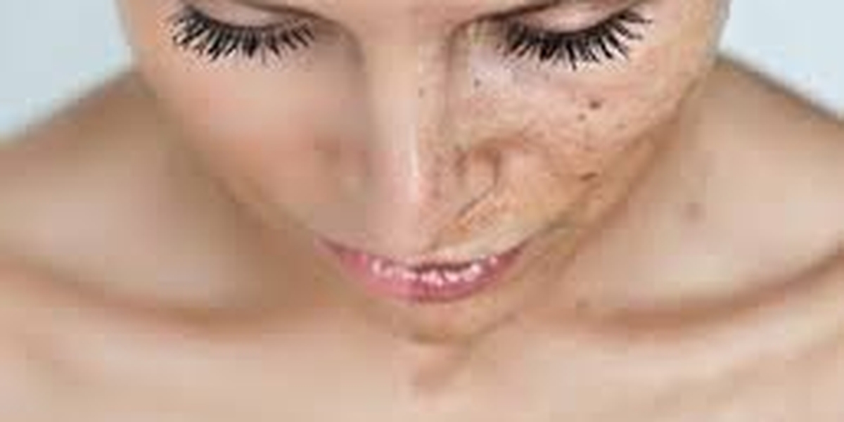 Dicas de maquiagem para pele manchada - Guiame