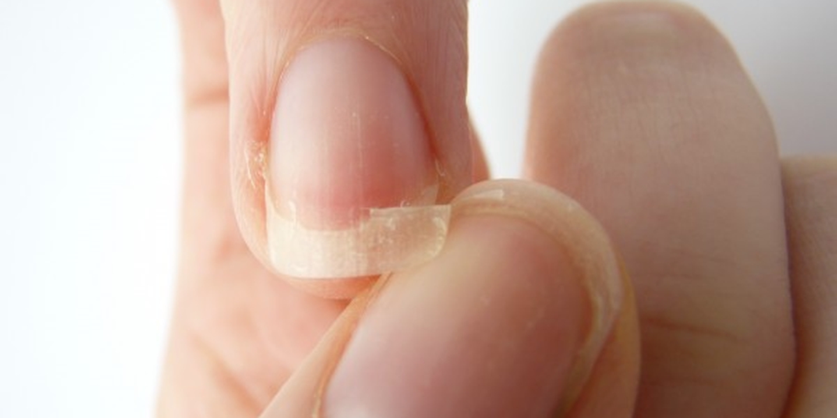 Unhas quebradiças: Conheça 4 dicas simples para que elas cresçam ...