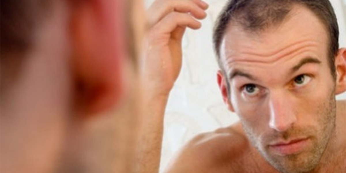 Conheça as possíveis causas e prevenção da calvície - Guiame