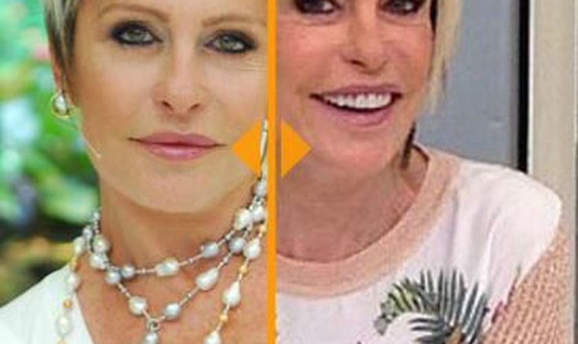 Confira o antes e o depois das famosas que aderiram ao botox - Guiame
