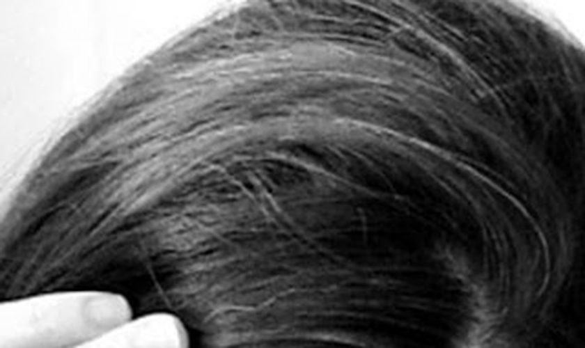 Arrancar fios brancos pode ser prejudicial à saúde. Saiba por que - Guiame